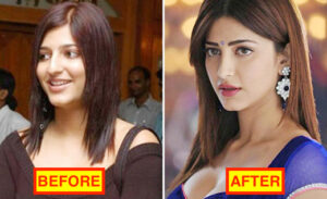 16 Actresses Who have Undergone Plastic Surgery - See Pics
